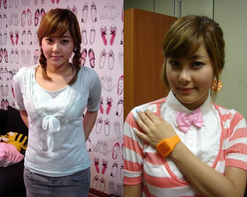 Solbi 再也不整形了? - Kpopn